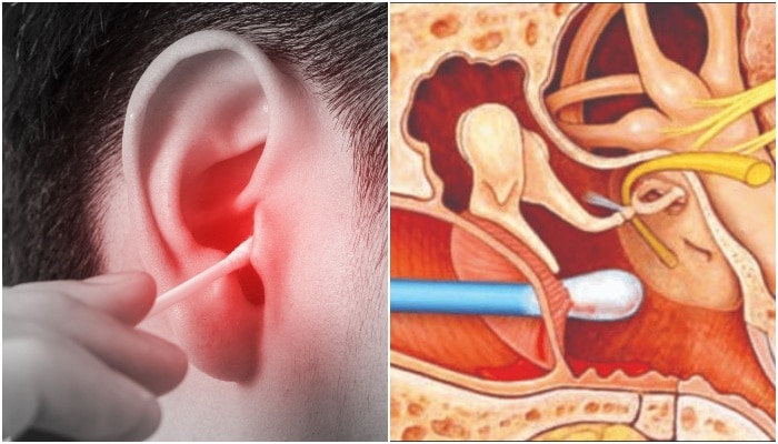সাবধান! ভুলেও কান খোঁচাতে কটন বাড ব্যবহার করবেন না, জেনে নিন বিশদে ...