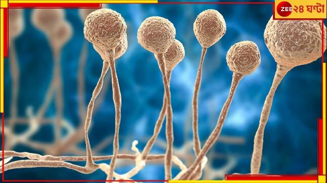 New deadly outbreak Superbug fungus Candida Auris WHO declared growing ...