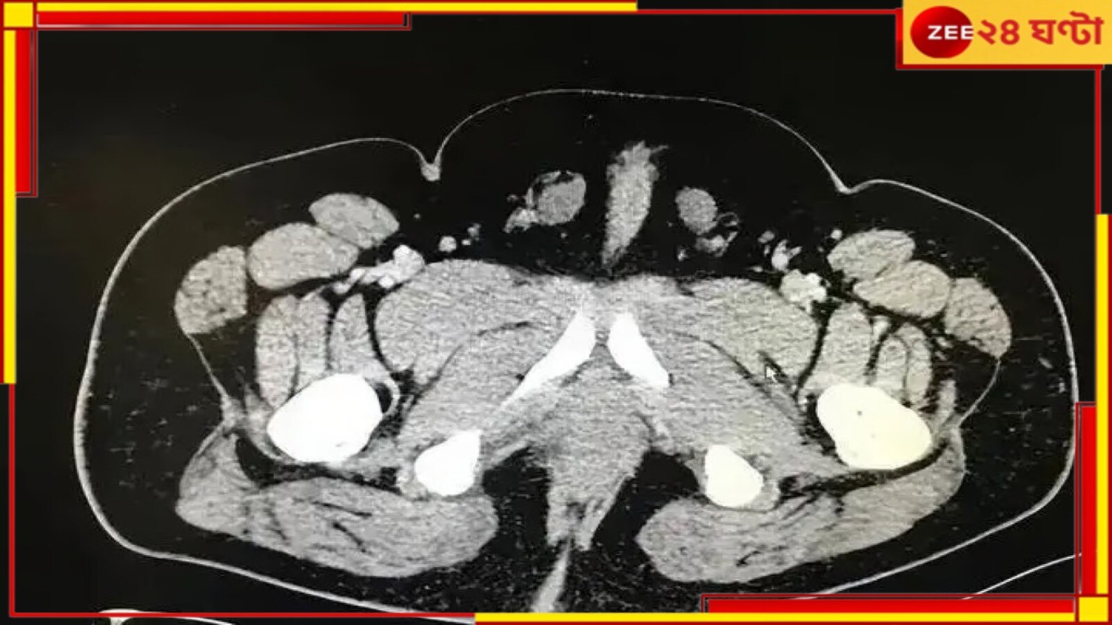 Dual reproductive systems: এক মহিলা একই সঙ্গে 'বাবা' এবং 'মা'! এক ...