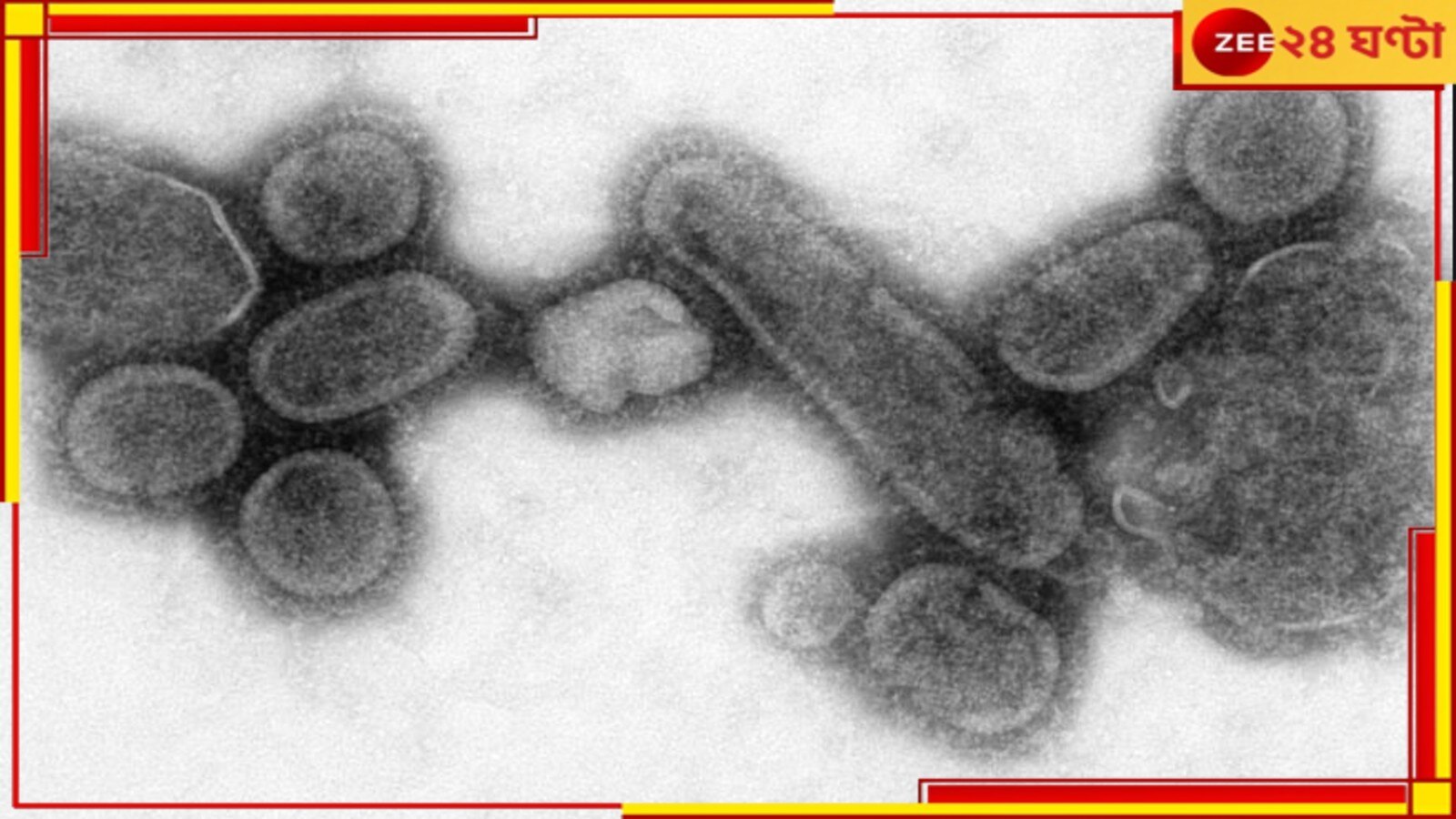 Avian flu: HMVP নয়, নতুন বছরে আতঙ্ক ছড়াতে আসছে এই সব ভয়ংকর রোগ ...