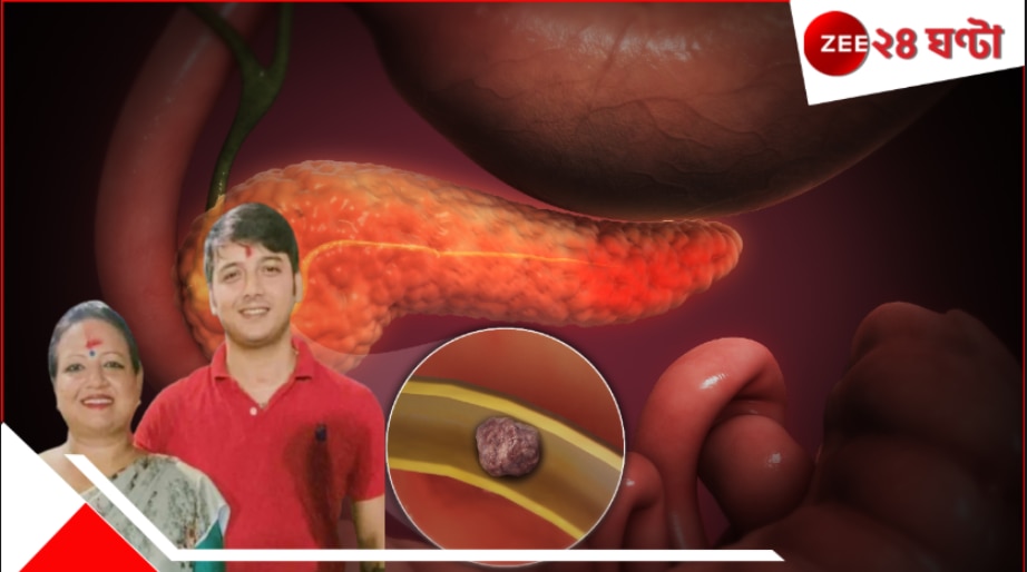 Hemorrhagic Pancreatitis: হেমরেজিক প্যানক্রিয়াটাইটিসে ২৫-এই মৃত্যু প্রীতমের! কী এই ভয়ংকর রোগ ...