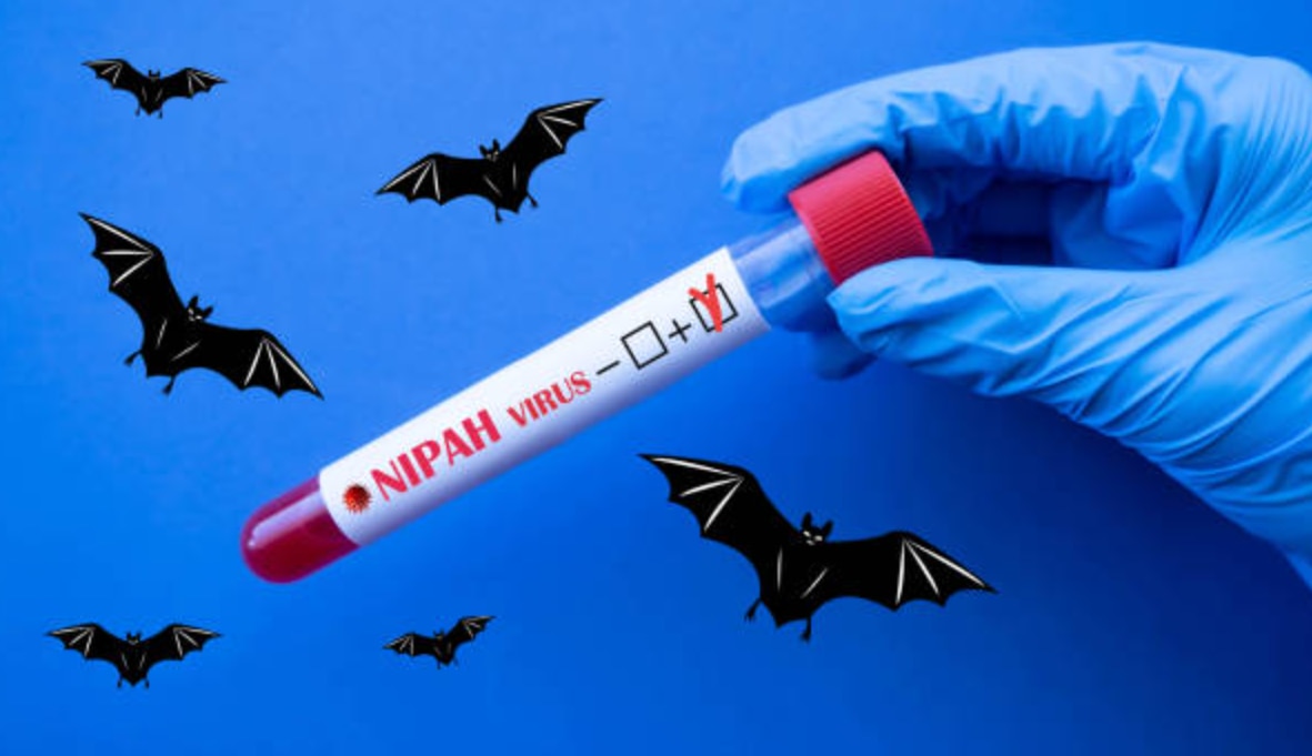 Nipah Virus Outbreak: মস্তিষ্কে শক থেকে শুরু করে... কোন ৫ ভয়ংকর কারণে ...